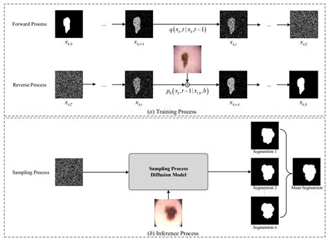 Dpusegdiff A Dual Path U Net Segmentation Diffusion Model For Medical Image Segmentation