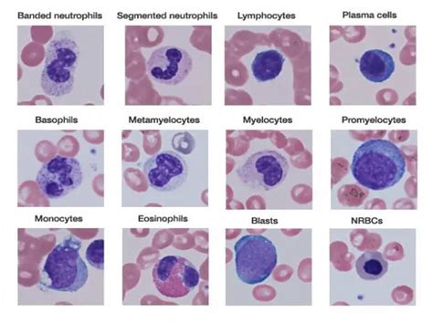 Segmented Neutrophils Nejm On X 🧵 Weekend Briefing For November