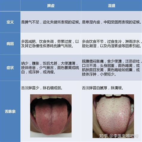 脾虚如何调理？ 知乎