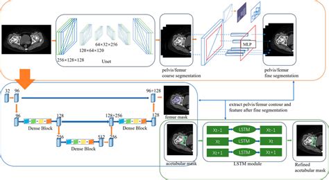 schematic diagram of bone segmentation based on the unique algorithm