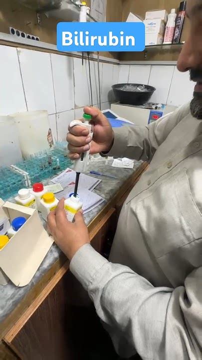 Serum Bilirubin Total Total Bilirubin Directbilirubin Indirect Bilirubin Liver Function Test