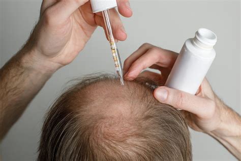 How Does Minoxidil Work Drhair