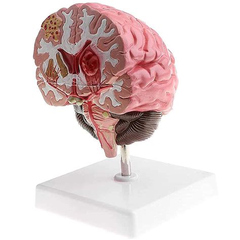 Buy Pathological Brain Structure Anatomy Model Life Size Human Brain