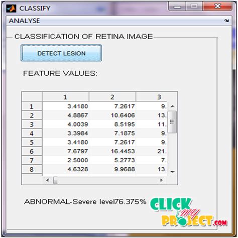 Automatic Assessment Of Macular Edema From Color Retinal Images ClickMyproject