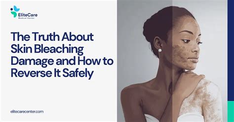 The Truth About Skin Bleaching Damage And How To Reverse It Safely