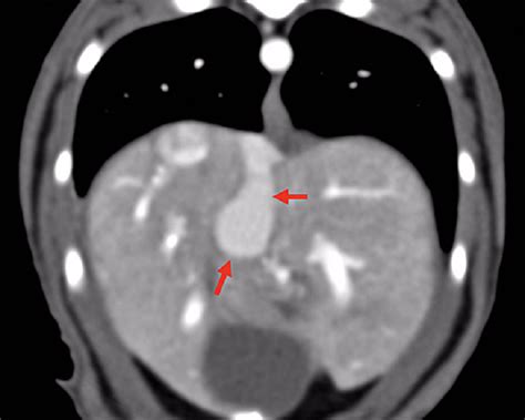 Liver Intrahepatic Portosystemic Shunt Portal Phase Ct Angiography In Cats Felis Vetlexicon