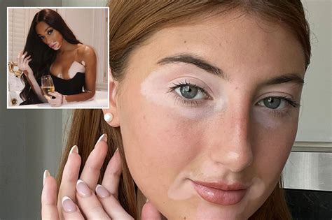 Cruel Trolls Give Me Funny Looks And Accuse Me Of Really Bad Fake Tan