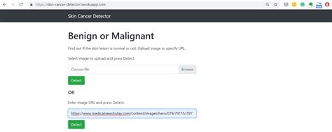 skin cancer detection transferlearning fastai flask devpost