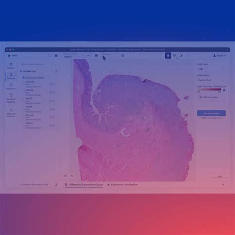 10x Genomics On Linkedin Map Spatial Gene Expression In High Definition