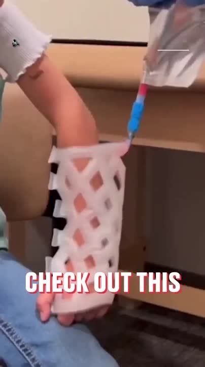 Artificially Professional On Linkedin Orthopedicinnovation Patientcare Medicaltech