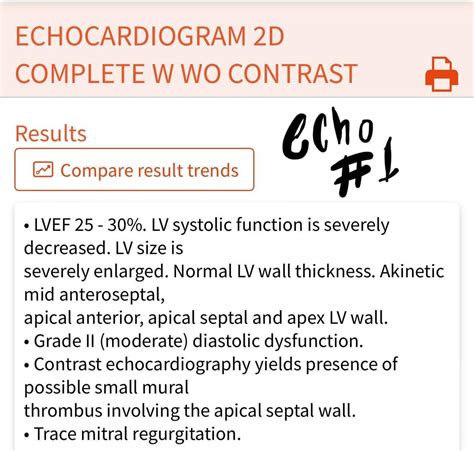 Posted Yesterday About My 47 Yo Brothers Chf Here Are His Last Two Echos Anyone Have Any