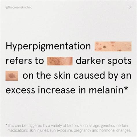 Unveiling The Complexities Of Hyperpigmentation Personalised Approach At — The Dream Skin
