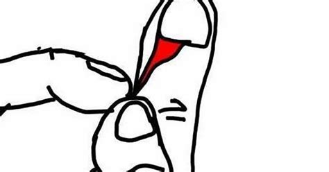 The Lifecycle Of A Hangnail Imgur