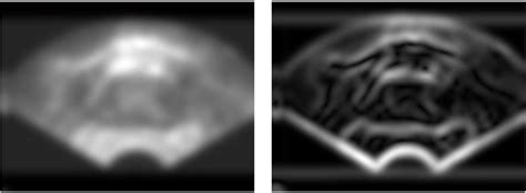 Energy Fields Derived From Dyadic Wavelet Transformation A An