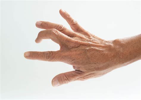 Trigger Finger Release Plastic And Reconstructive Surgery