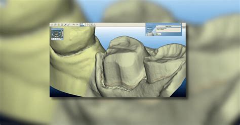 Fattibilità Della Valutazione Basata Su Software Per La Valutazione Automatizzata Della