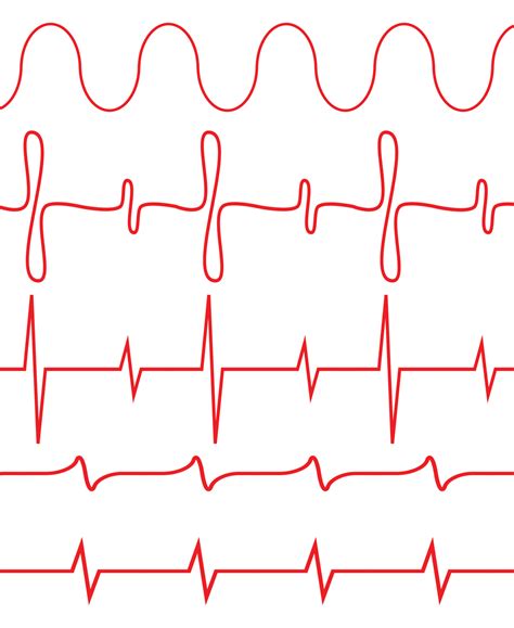 Seamless Set Of Lines Heartbeat 23107773 Vector Art At Vecteezy