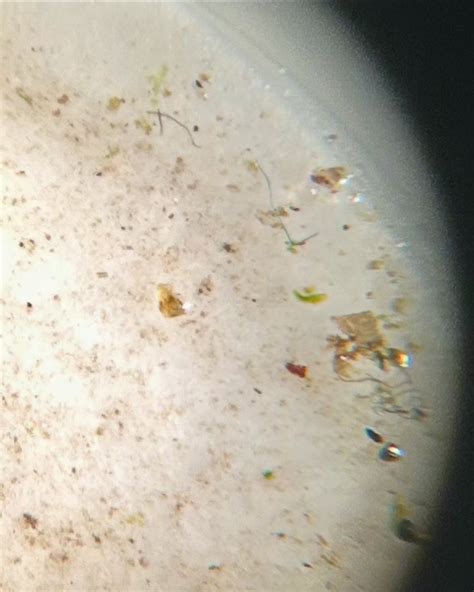 Liveswithlessplastic Have You Ever Seen Microfibres Under A Microscope In This Image They Are