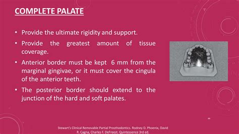 Components Of Rpd And Major Connectors Dr Shuchi Jain Pptx