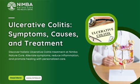 Ulcerative Colitis Symptoms Causes Treatment Sterna Biologicals Dna