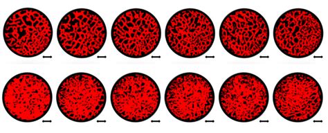Quantitative Micro Ct Analysis Of Femoral Head Bone Samples