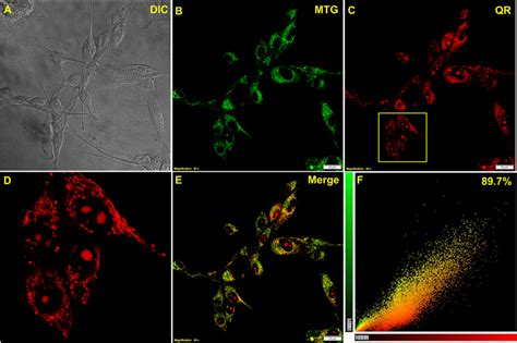 Confocal Live Cell Colocalization Experiments In U 87 Mg Cells A Dic