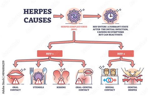 Herpes Causes And Medical Skin Hsv Virus Transmission Outline Diagram
