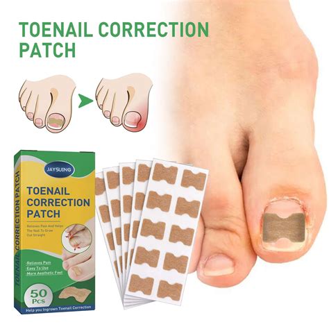 Xinyuan Toenail Corrector Patch Ingrown Toenail Strips Waterproof And