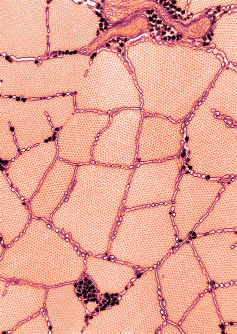 Frog Muscle TEM Stock Image C028 3877 Science Photo Library