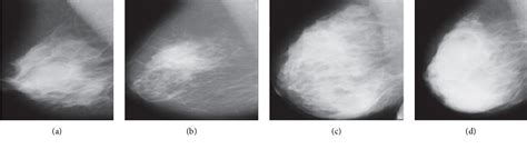 Figure 1 From Cloud Computing Based Framework For Breast Tumor Image Classification Using Fusion