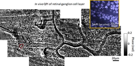 Quantitative Phase Imaging Research Projects Schallek Lab University Of Rochester Medical