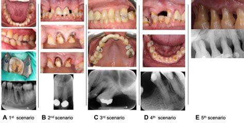 Photos Of Clinical Scenarios Download Scientific Diagram
