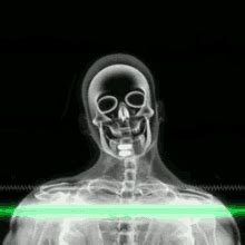 X Ray Animations Animated S And Clip Arts All 100 Free