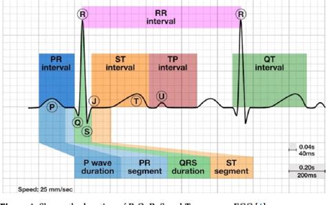 Figure 1 From Detection Of Myocardial Infarction Using Hybrid Models Of