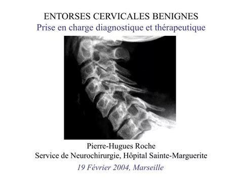 Ppt Entorses Cervicales Benignes Prise En Charge Diagnostique Et