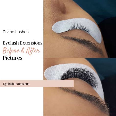 Blepharitis From Eyelash Extensions How To Treat And Prevent
