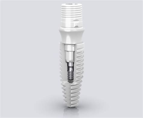 Ceramic Dental Implants In Turkey Aesthetic And Durable