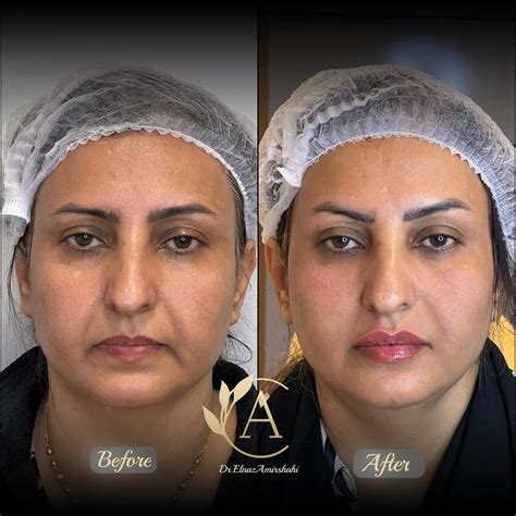 ‎دکتر الناز امیرشاهیپزشک پوست و زیبایی‎ Drelnazamirshahi