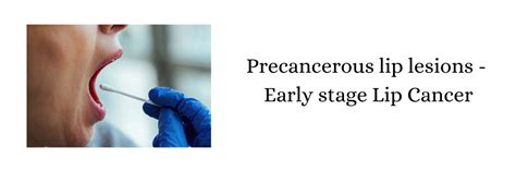 Precancerous Lip Lesions Early Stage Lip Cancer