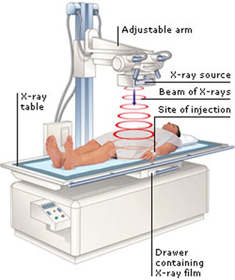 Ivp Procedure Deep Medical Centre