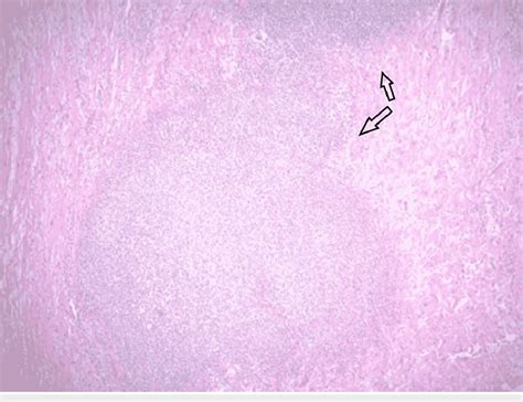 Light Micrograph Section Through The Heart Tissue Lvot Download