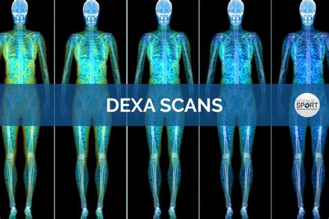 DEXA Scans Science For Sport