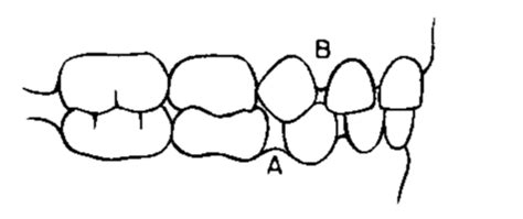 Primary Occlusion Flashcards Quizlet