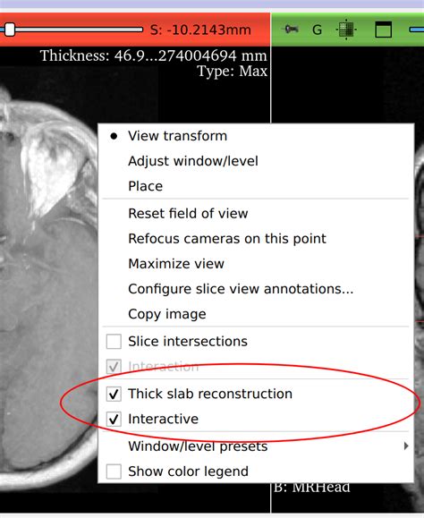 new feature thick slab reconstruction from slice controllers and views