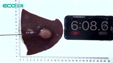 亿高医疗一次性冷循环微波消融针（1 4mm）圆消融实验 高清1080p在线观看平台 腾讯视频