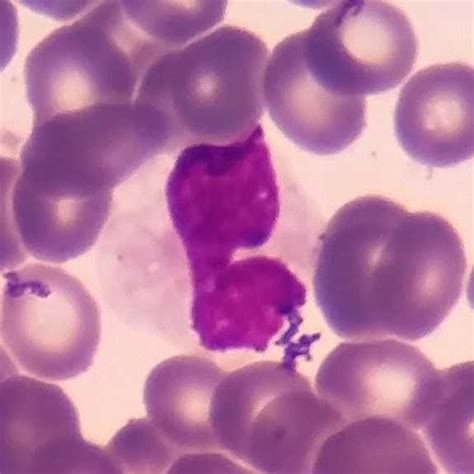 Monocyte Object Detection Dataset By Shool