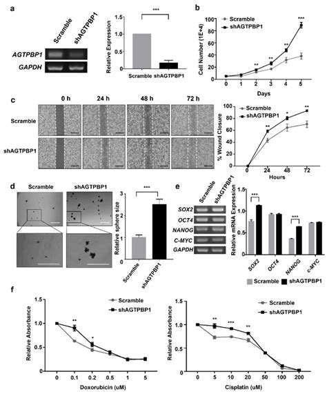 atp gtp binding protein 1 agtpbp1 silencing in the a549 lung cancer