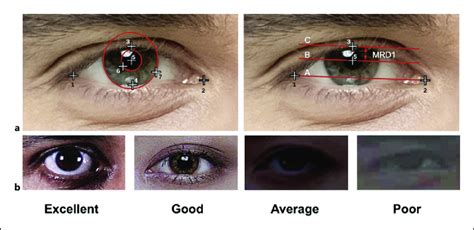 Manual Annotation Of Study Data To Create A Labeled Dataset For Model Download Scientific