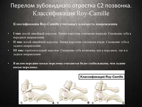 Травматические повреждения позвоночника и спинного мозга презентация онлайн