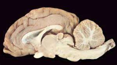 Sheep Brain Labeling 1 Diagram Quizlet